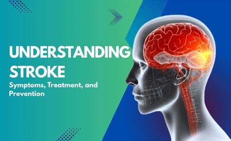 Understanding Stroke Symptoms Treatment And Prevention