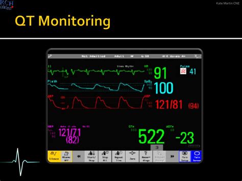Ppt Beyond Arrhythmias St And Qt Segment Monitoring Powerpoint Presentation Id 3223037