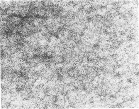 Electron Micrograph Of Purified Gonococcal Pili From Strain F62 The