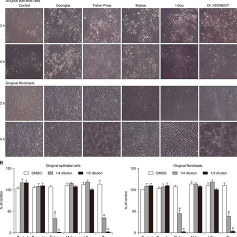 Desquamative Gingivitis Associated With Oral Lichen Planus Patchy