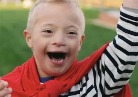 Down Syndrome