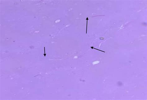 Dead And Alive Sperm Eosin Nigrosin Stain Download Scientific Diagram