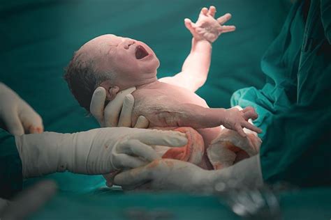 Basuru Olan Normal Doğum Yapabilir Mi Güncel Oku