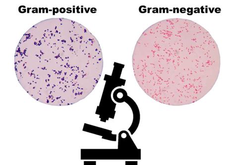 Gram Staining Principles Methods And Procedures Introduction To