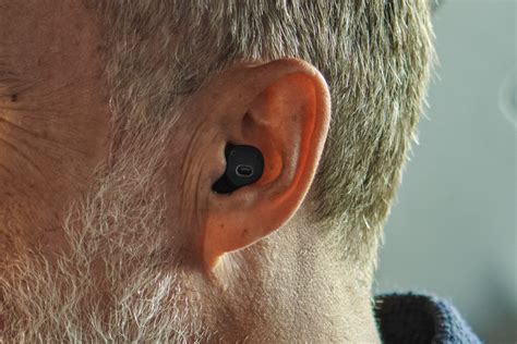 Was Ist Eine Parotitis Amplifon Ch