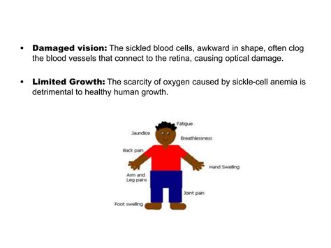 Sickle Cell Anemia Powerpoint Presentation Pptx