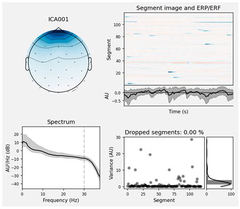 Sustainability Free Full Text Feature Extraction And Classification Of Motor Imagery Eeg