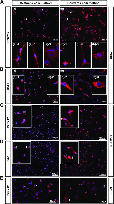 Characterization Of Human Ipsc Derived Microglia By Download