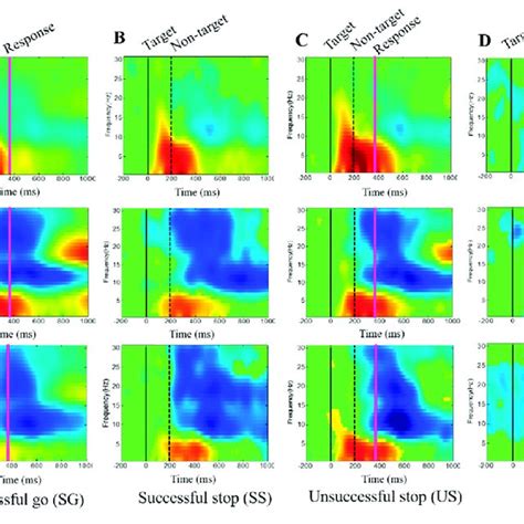Eeg Dipole Source Location And Scalp Map Of Six Clusters Including A