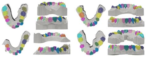 Bioengineering Special Issue Ai Powered Diagnosis And Treatment