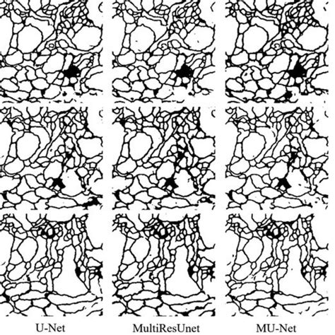 the segmentation results of the em challenge dataset download scientific diagram