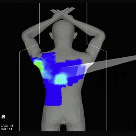 Syed Umer Saeed Posted On Linkedin