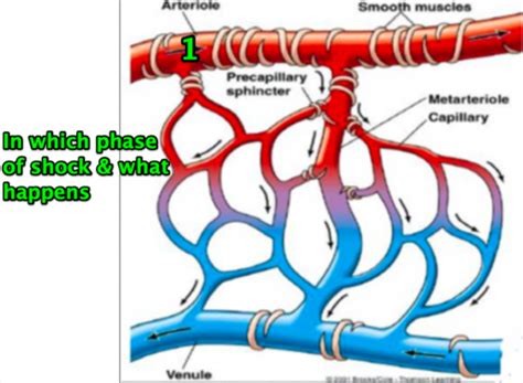 T12 Types Of Circulatory Shock Flashcards Quizlet