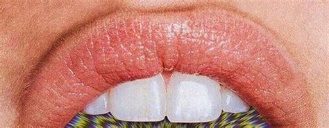 Lisph ВКонтакте