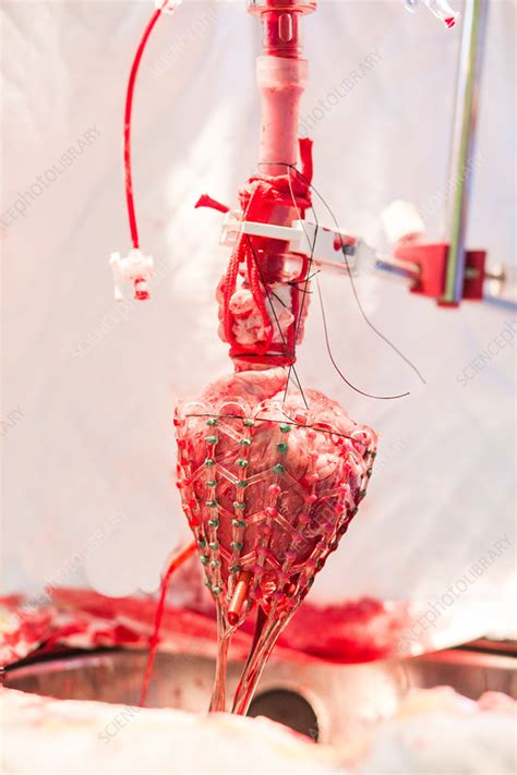 Research In Cardiology Stock Image C0353528 Science Photo Library
