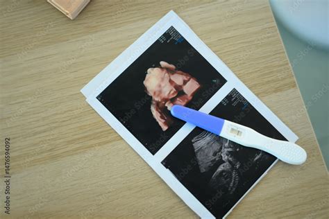 3d And 2d Ultrasound Pictures With A Pregnancy Test Fetal Development