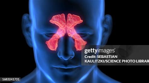 Inflamed Sinuses Illustration High Res Vector Graphic Getty Images