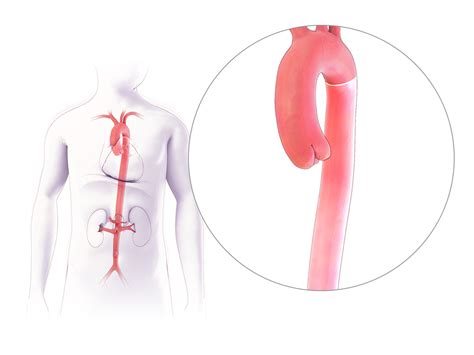 Aorta Oh 46 Photos Sex And Porn