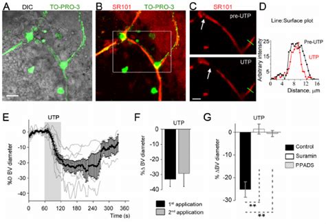 Utp Activation Of Pericytes Leads To Capillary Constriction Download
