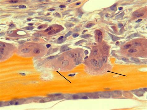 Advances In The Regulation Of Osteoclasts And Osteoclast Functions