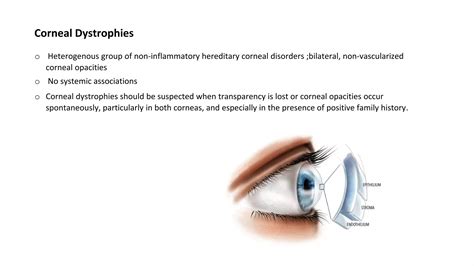Corneal Dystrophy Pptx