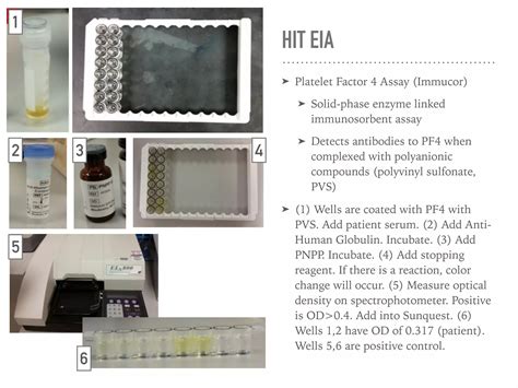 Heparin Induced Thrombocytopenia Pdf