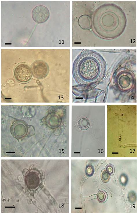 Oomycetes Microscope