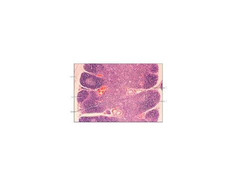 Micrograph Of Thymus Quiz