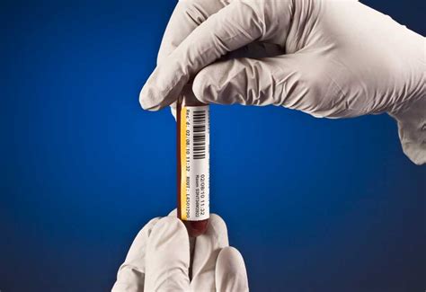 Labeling Ampules A Real Time Mass Production Challenge