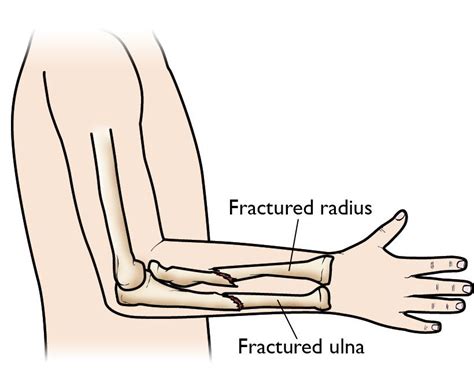 Blog Page 32 Of 65 New Mexico Orthopaedic Associates