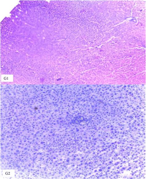 Histopathology Of The Liver G1 Distilled H 2 O Treated Group And G2
