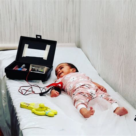 Cf Sweat Test For Cystic Fibrosis 🪄raha🪽 Atyabi🌟 Posted On The Topic