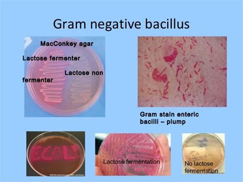 Bacteriology