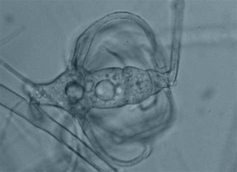 Zygosporangium Fungi