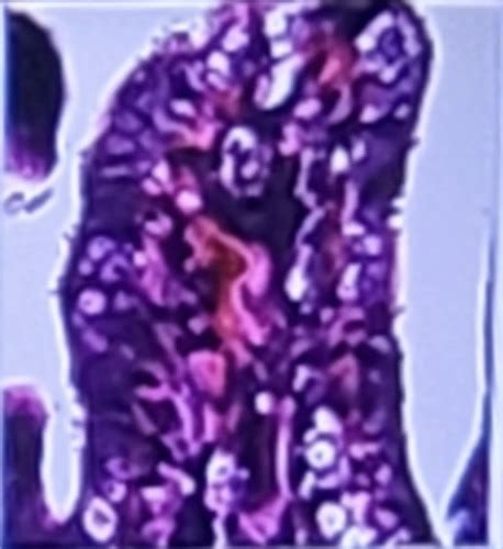 Phylum Apicomplexa Flashcards Quizlet