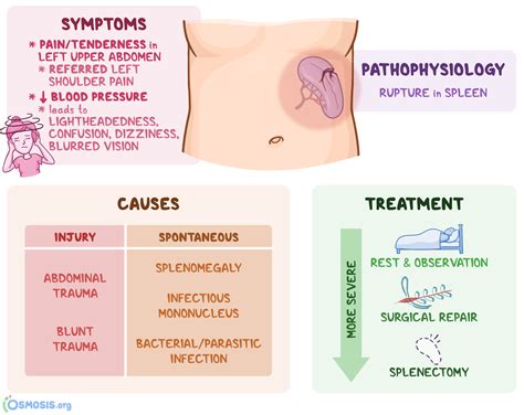 How Serious Is A Ruptured Spleen