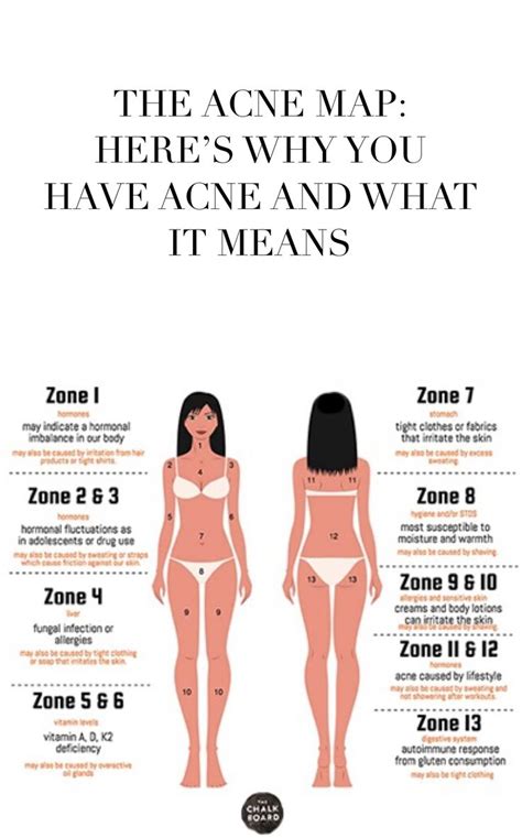 What Your Acne Map Is Telling You The Chalkboard Acne Mapping Body Acne Map Face Mapping Acne