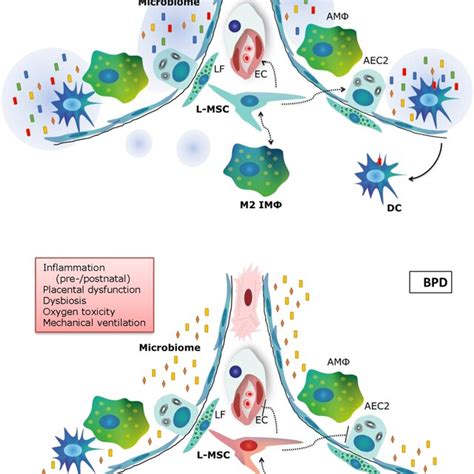 A Schematic Overview Of The Pathophysiology Of Bronchopulmonary Download Scientific Diagram