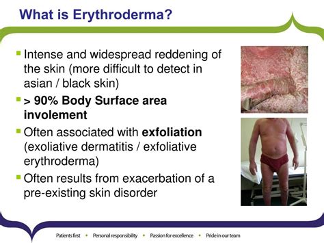 Ppt Emergency Dermatology Dr Melissa Barkham Spotlight Seminar 30 Th September 2010 Powerpoint