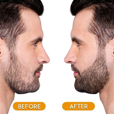 Beard Pens And Pencil Fillers Best Solutions For Your Patchy Beard