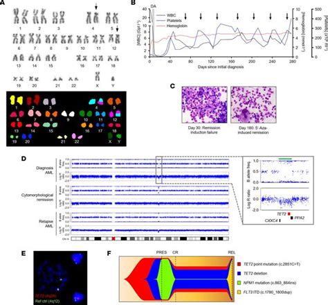 Jci Insight Biallelic Tet2 Mutations Confer Sensitivity To 5