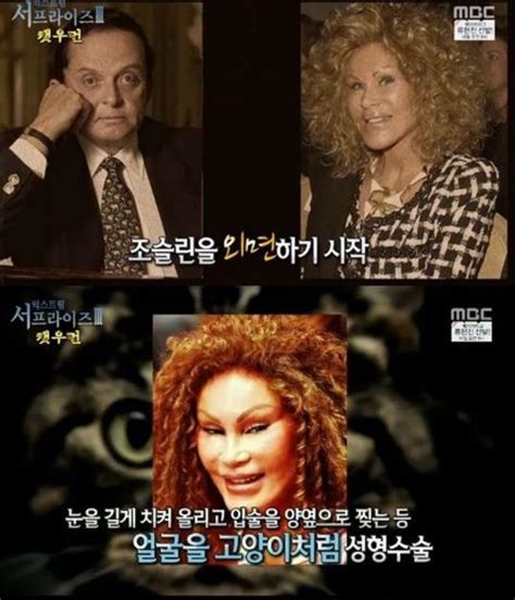 서프라이즈 조슬린 남편 사랑 얻으려 캣우먼 된 사연 공개