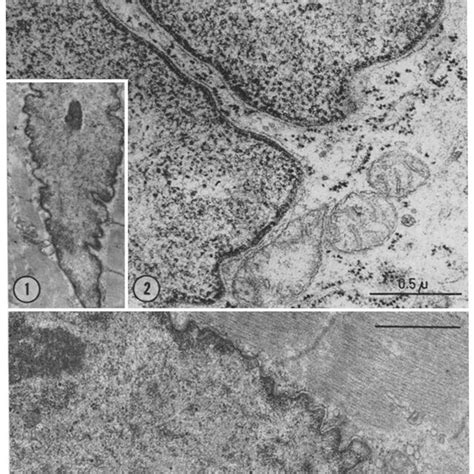 Typical Rat Skeletal Muscle Nucleus Showing The Greatly Invaginated