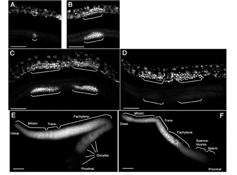 Germline Expression Of Fog 2 During C Elegans Development A D Dapi