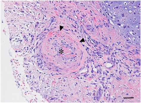 Histopathological Section Of The Central Part Of A Chondrosarcoma Dog