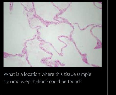 Solved What Is A Location Where This Tissue Simple Squamous