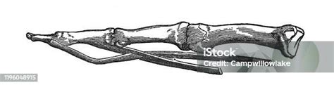 Ilustrasi Antik Tulang Metacarpal Dan Falangeal Jari Dengan Tendon Dan
