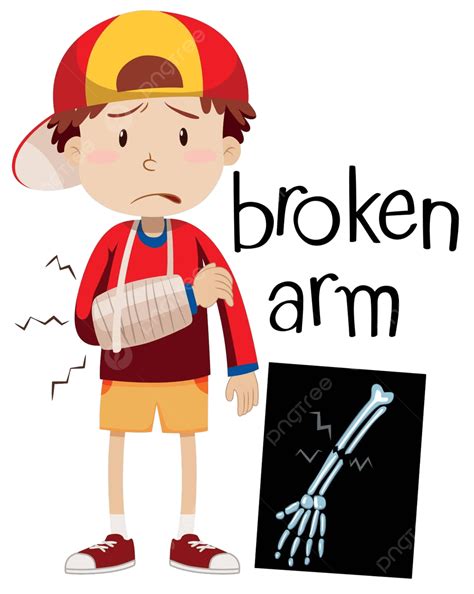 Broken Bones Clipart