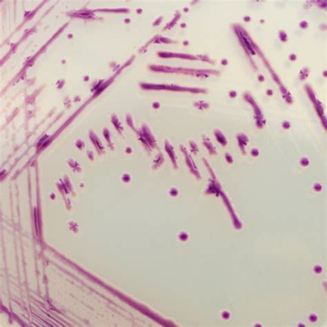 What Is Pasteurella At Tracy Macias Blog