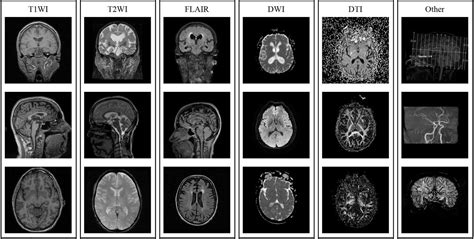 Radiology Mri Sequences
